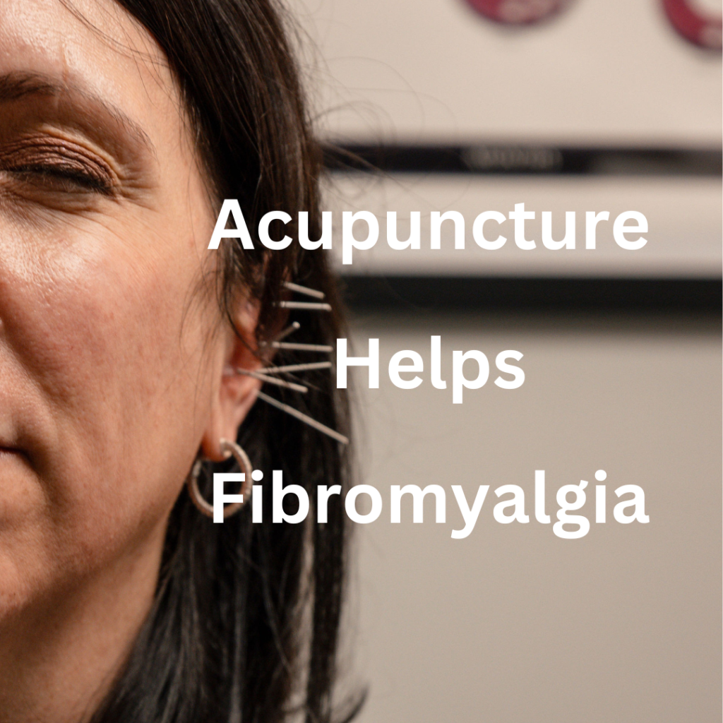 Acupuncture Helps Fibromyalgia
